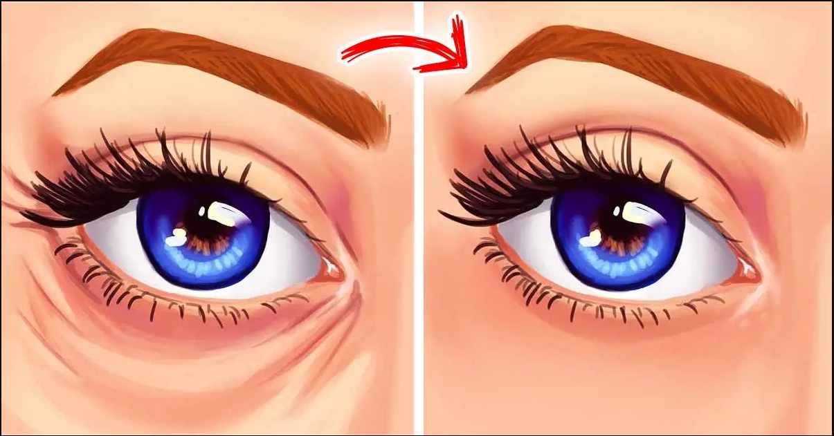 Comment atténuer les rides sous les yeux avec des ingrédients naturels ...